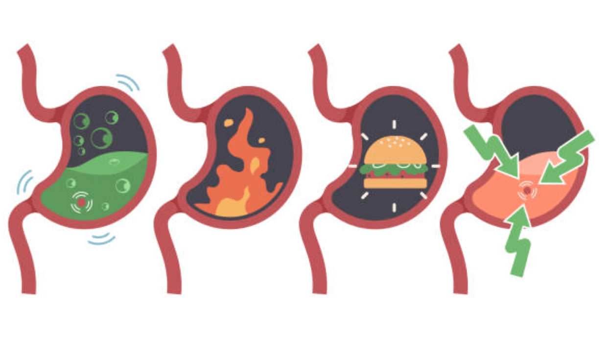 Diet Chart for Gastric Problems By Dietician Priyanka Jaiswal